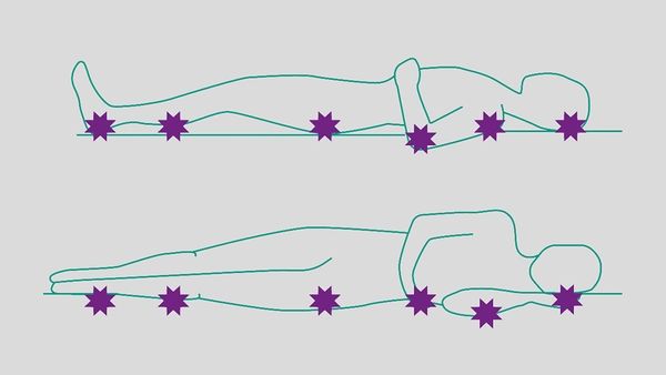 Wound Care: Prevention and Management of Chronic Wounds